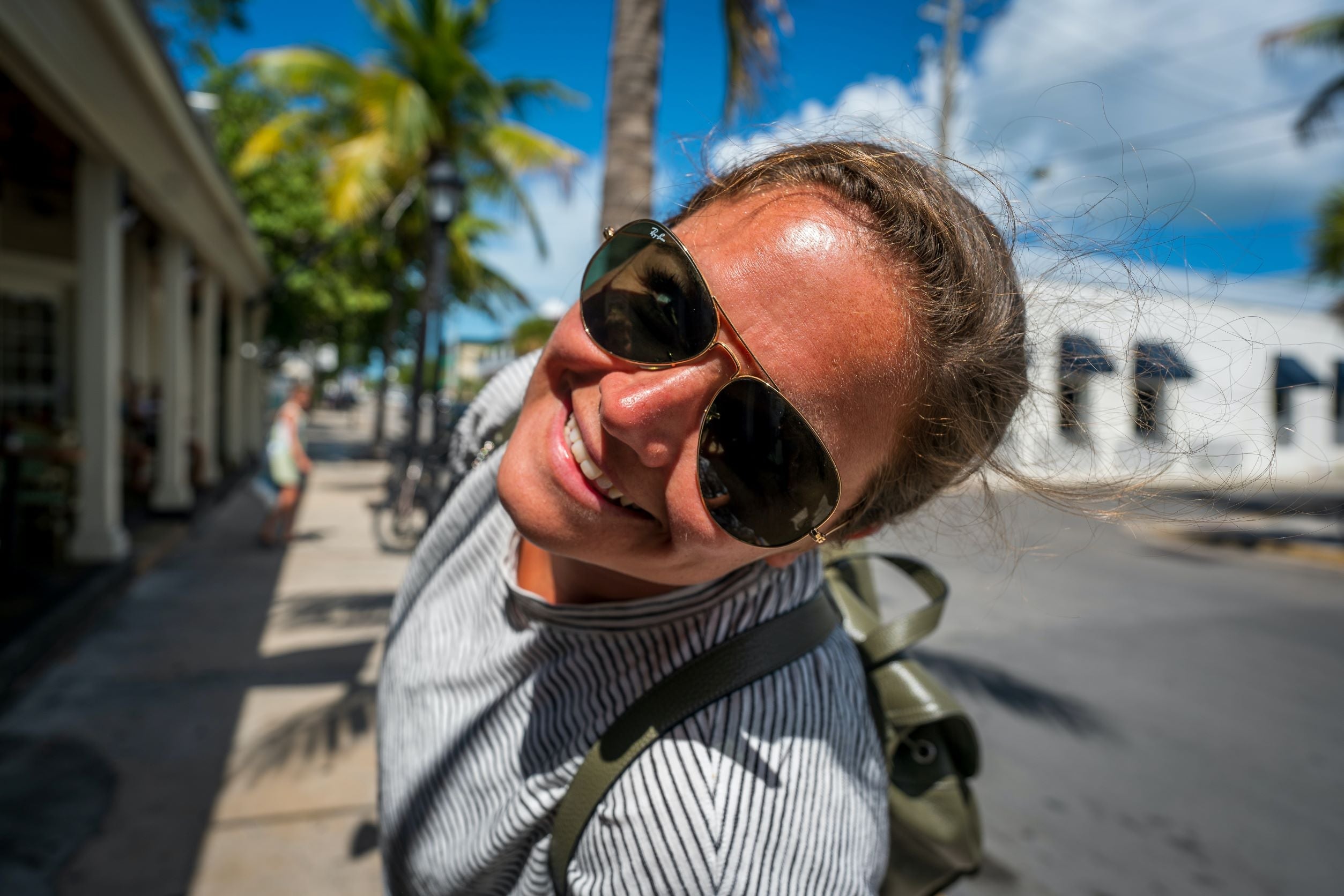 A Bunch of Remedies That Can Help Soothe and Heal Sunburn: - Nutrition ...